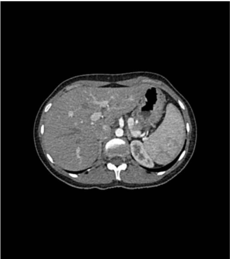 PhantomX | The World's Most Realistic Phantoms