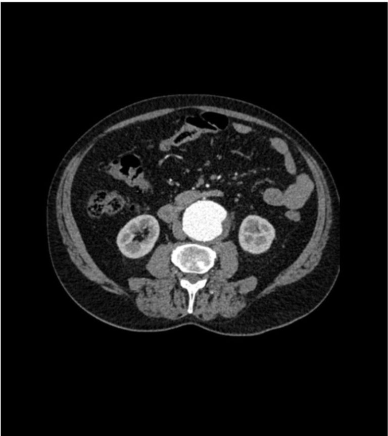 PhantomX | The World's Most Realistic Phantoms