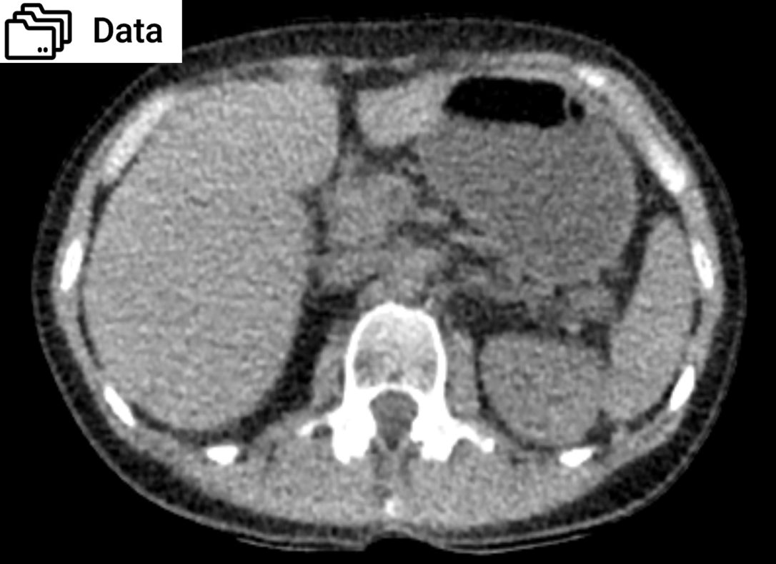 Abdomen / Pelvis CT Phantom Native - Dataset